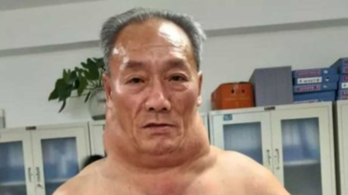 This Man’s Drinking Habits Had a Horrifying Effect on His Body