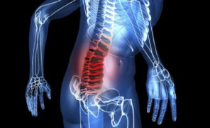 Degenerative Disc Disease (Discopathy): Symptoms, Causes, Treatment ...