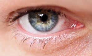 Degenerative Disc Disease (Discopathy): Symptoms, Causes, Treatment ...