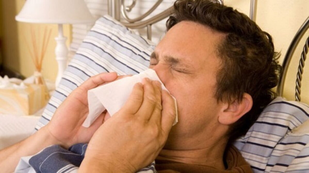 Flu (Influenza): Symptoms, Signs, Causes, Treatment, Remedies