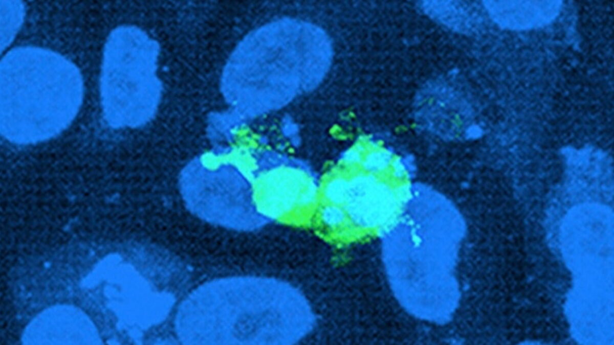 This Revolutionary New Video Shows How HIV Can Infect Cells