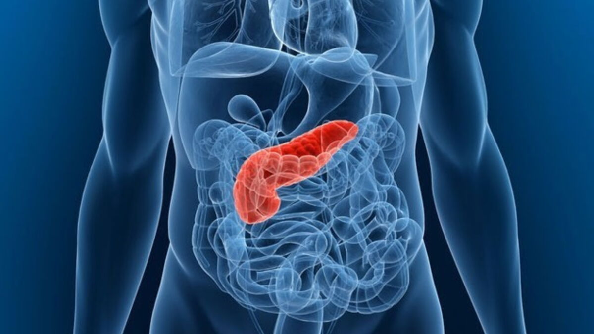Pancreatitis (Acute And Chronic): Signs, Symptoms, Causes, Treatment