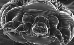 Ponytail Syndrome: Symptoms, Permanent After-Effects, Treatment