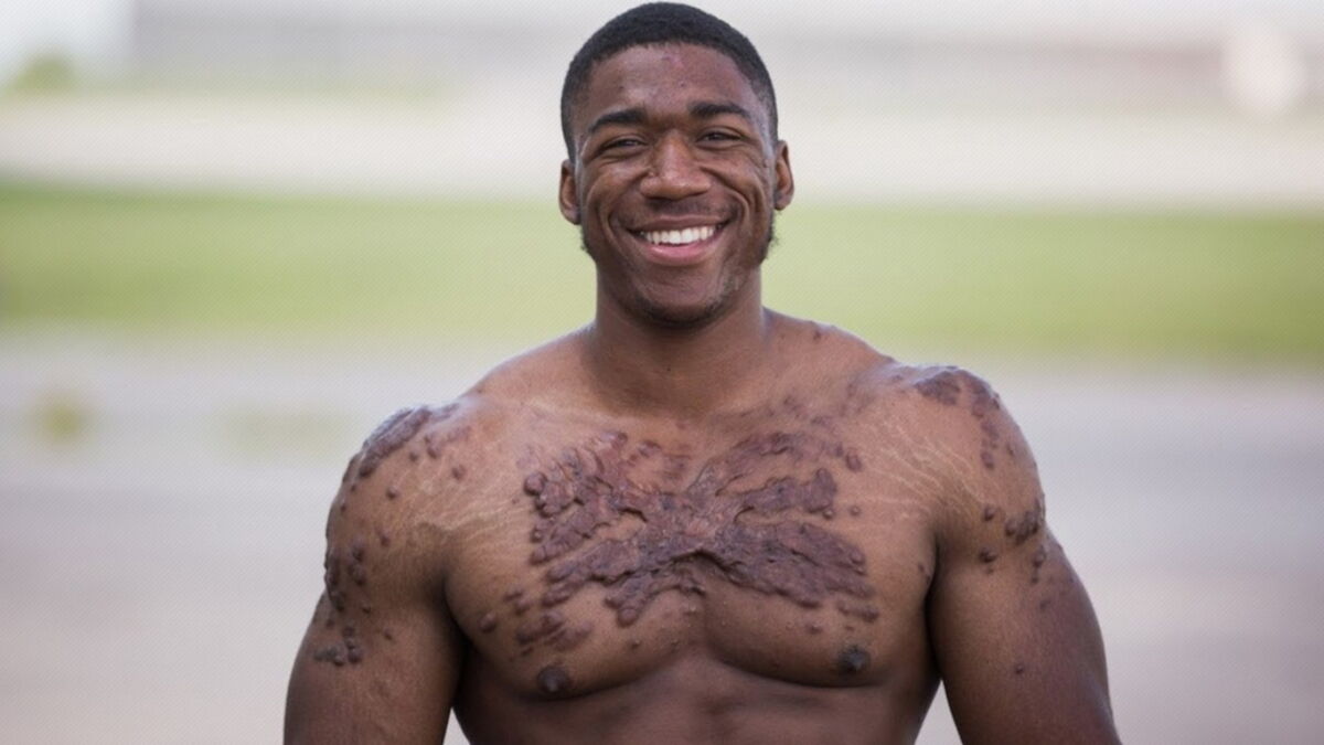 He couldn't bear to look in the mirror and now he's a bodybuilding champion