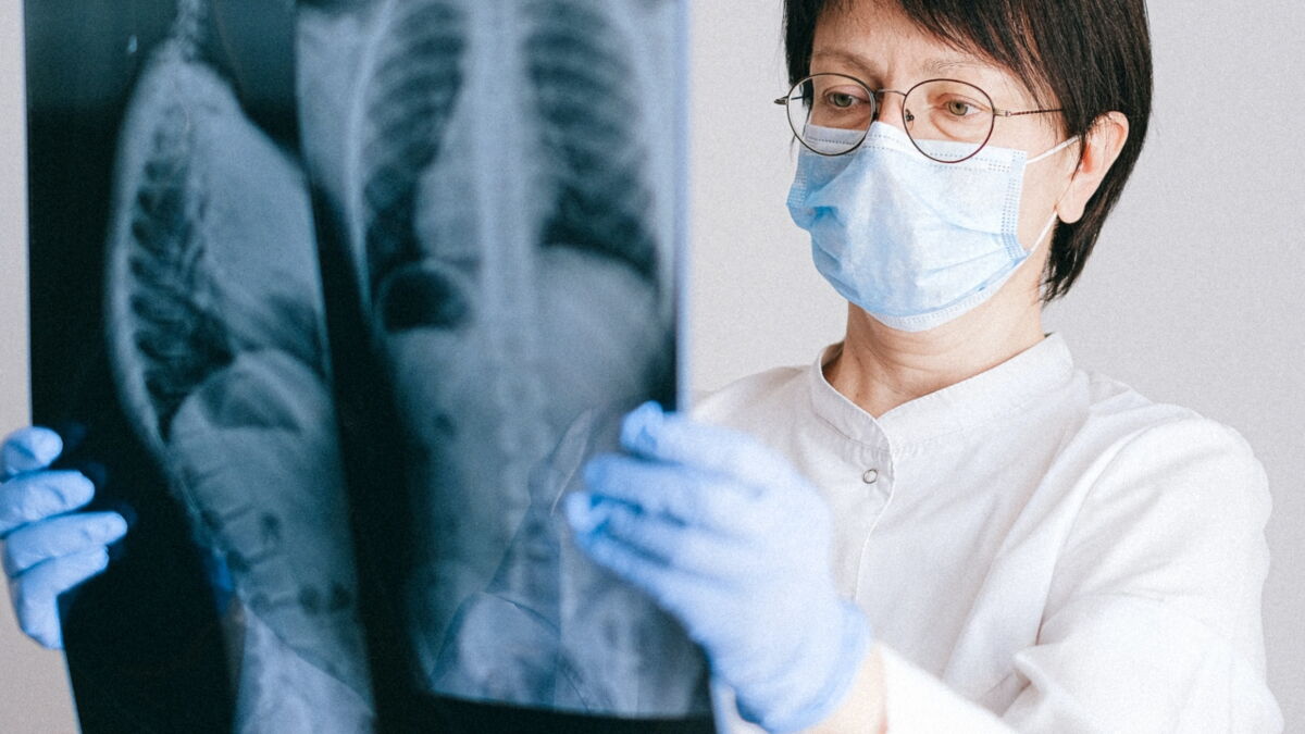 Lung cancer: This simple at-home finger test reveals the early signs