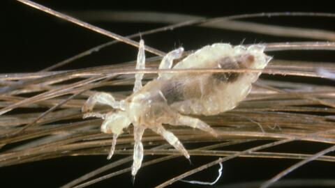 WATCH: Hairdresser films the worst lice infestation of her career