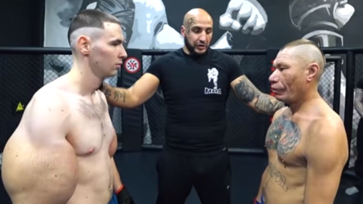 'Synthol Kid,' A Young Russian With Massive Arms, Participated In His ...