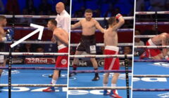 Boxer Cheyenne Hanson reveals images of her completely mangled face