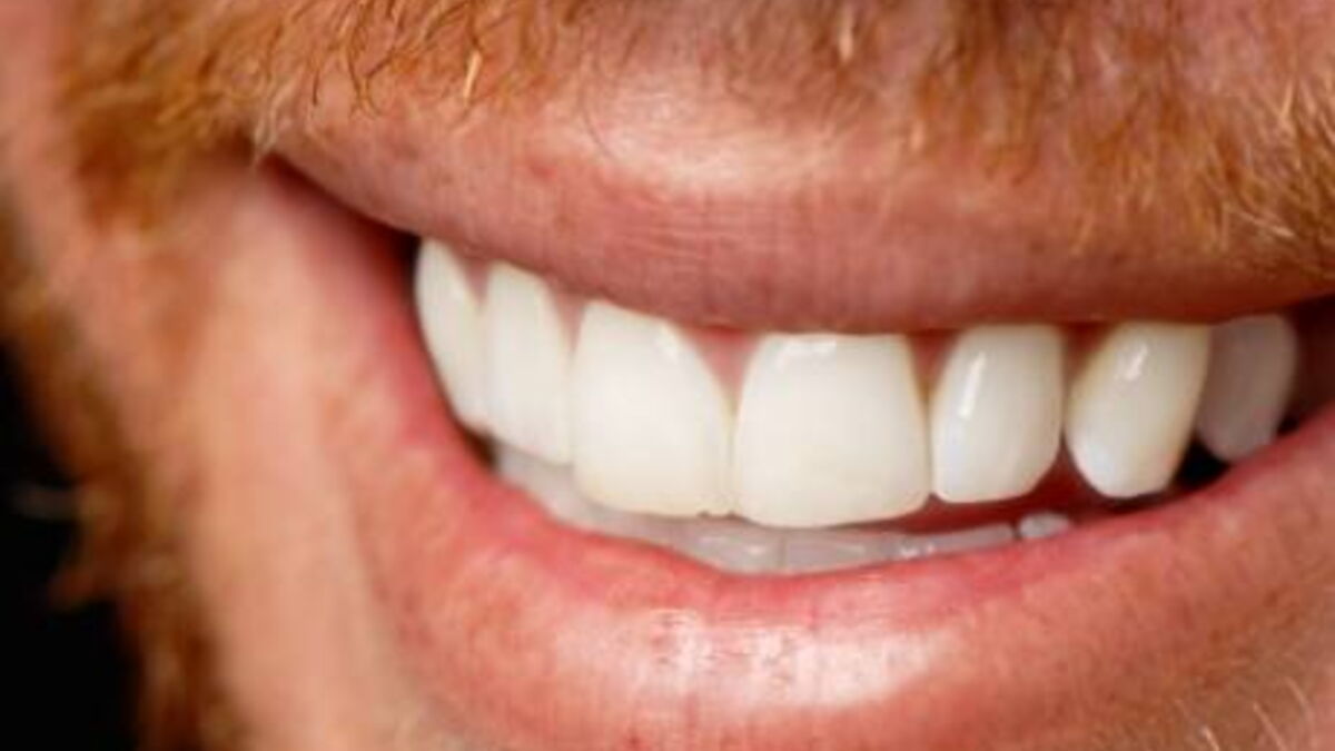 Découvrez la carstache : une moustache pour voiture