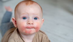 Angiom: Definition, Therapie und Behandlung, wie lässt es sich ...