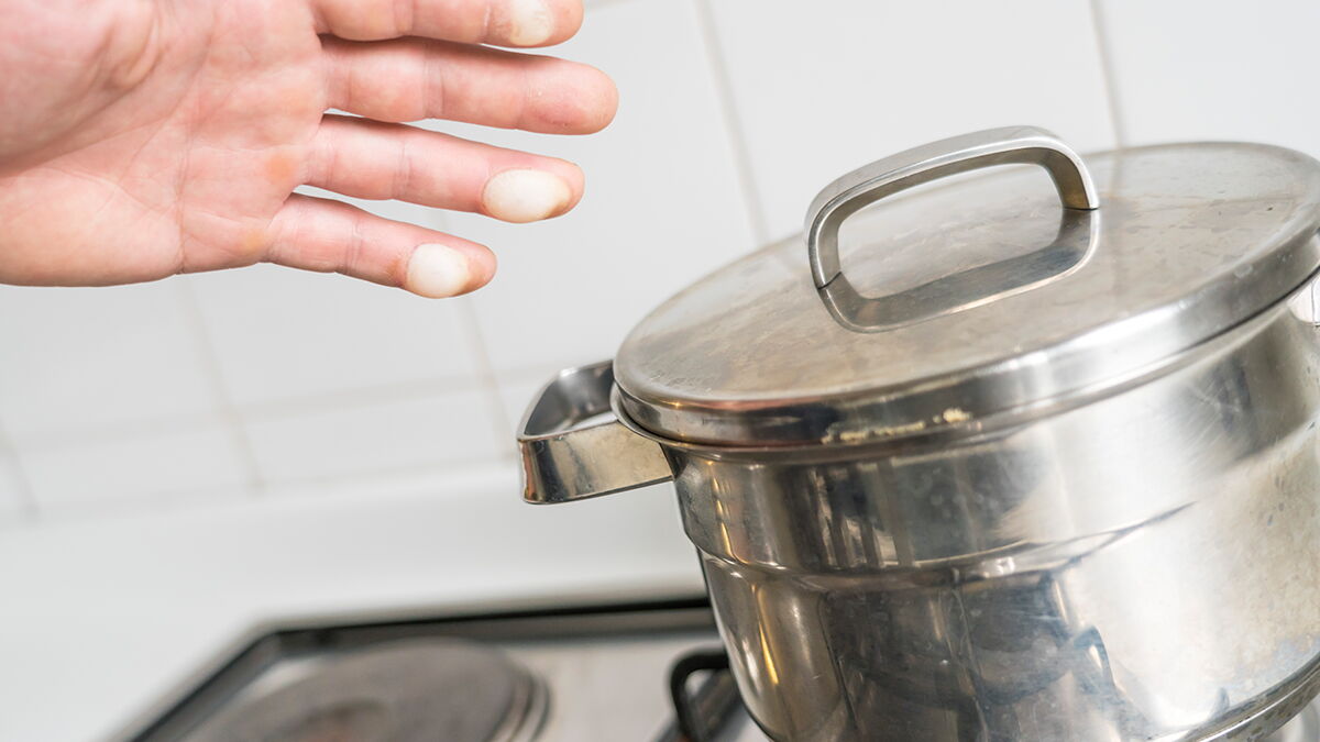 Verbrennungen: An diese wichtige Erste-Hilfe-Maßnahme denkt fast niemand