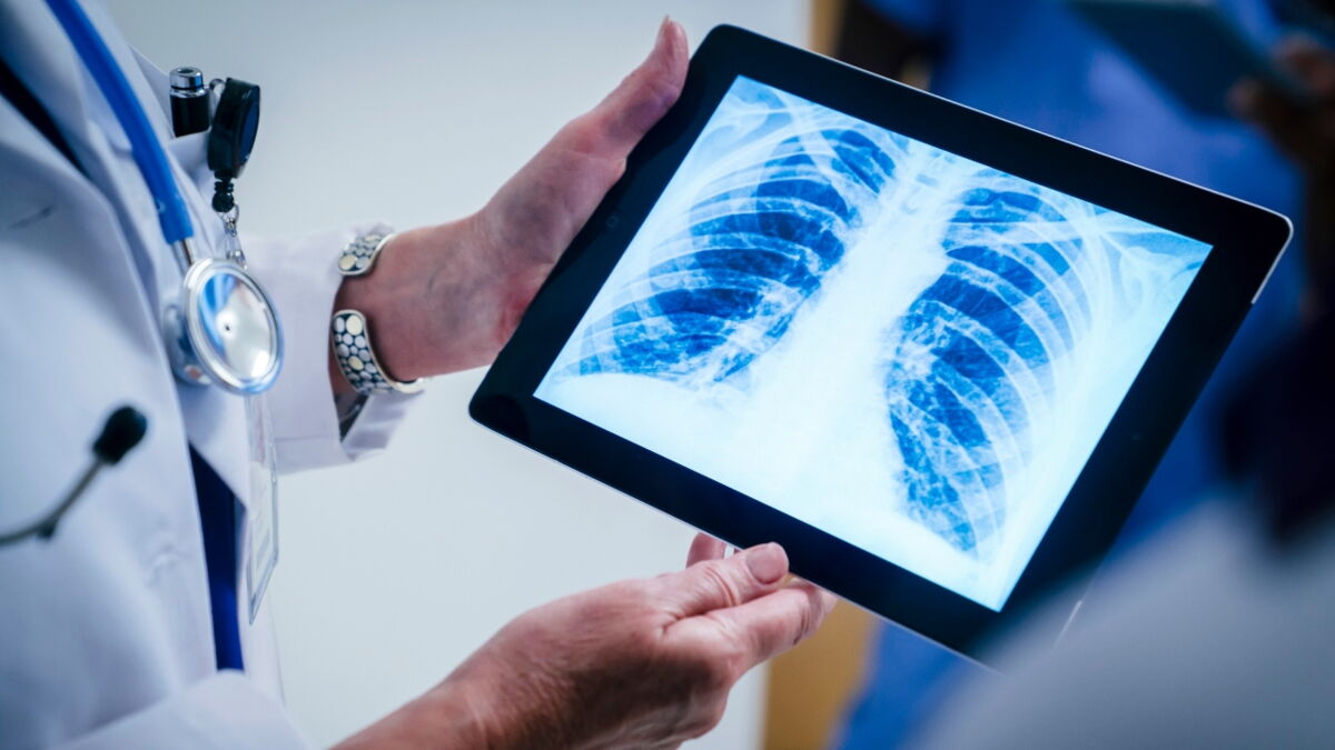 Zusätzliche Körperteile: Können sie auch Risiken bergen?