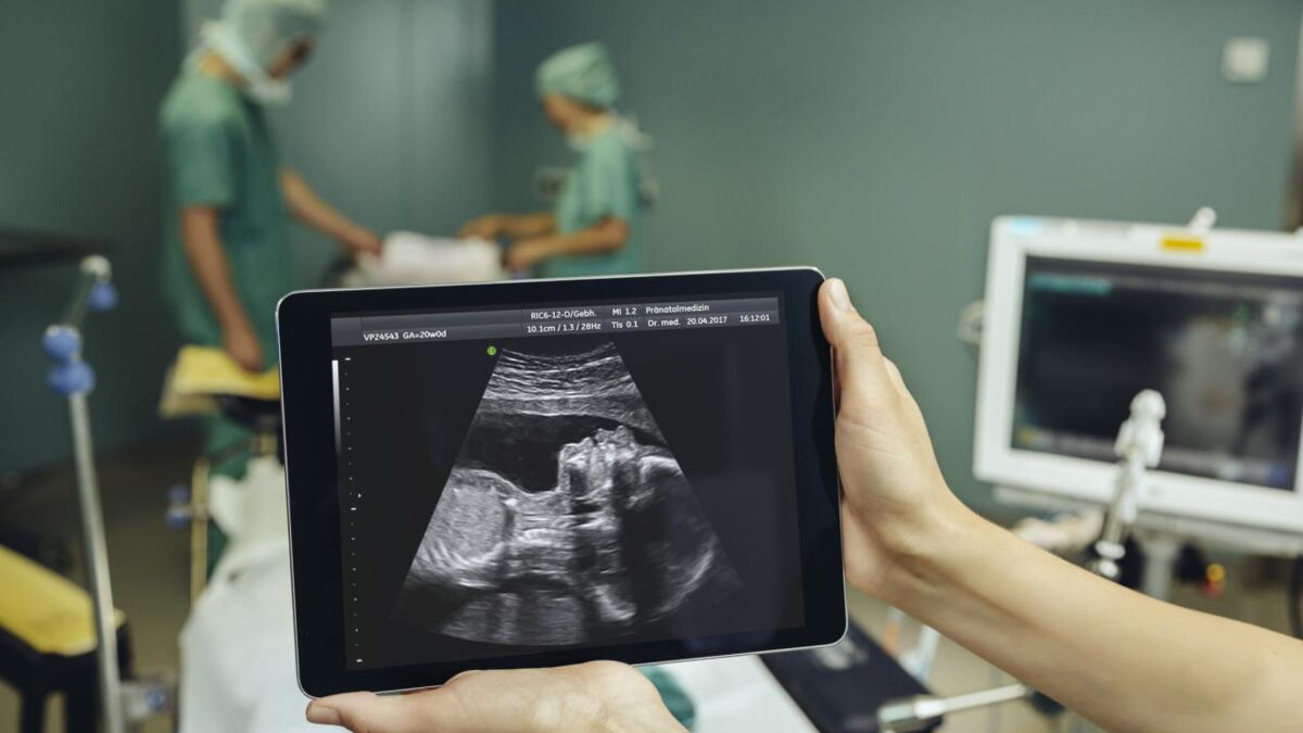 "Steinbaby": Brasilianerin ist über 50 Jahre "schwanger" und stirbt ...