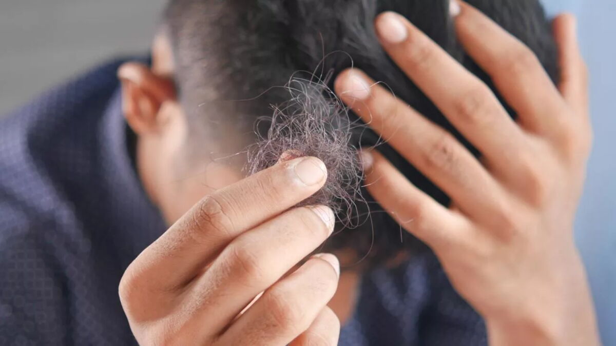 Haarausfall stoppen mit diesen simplen Tipps