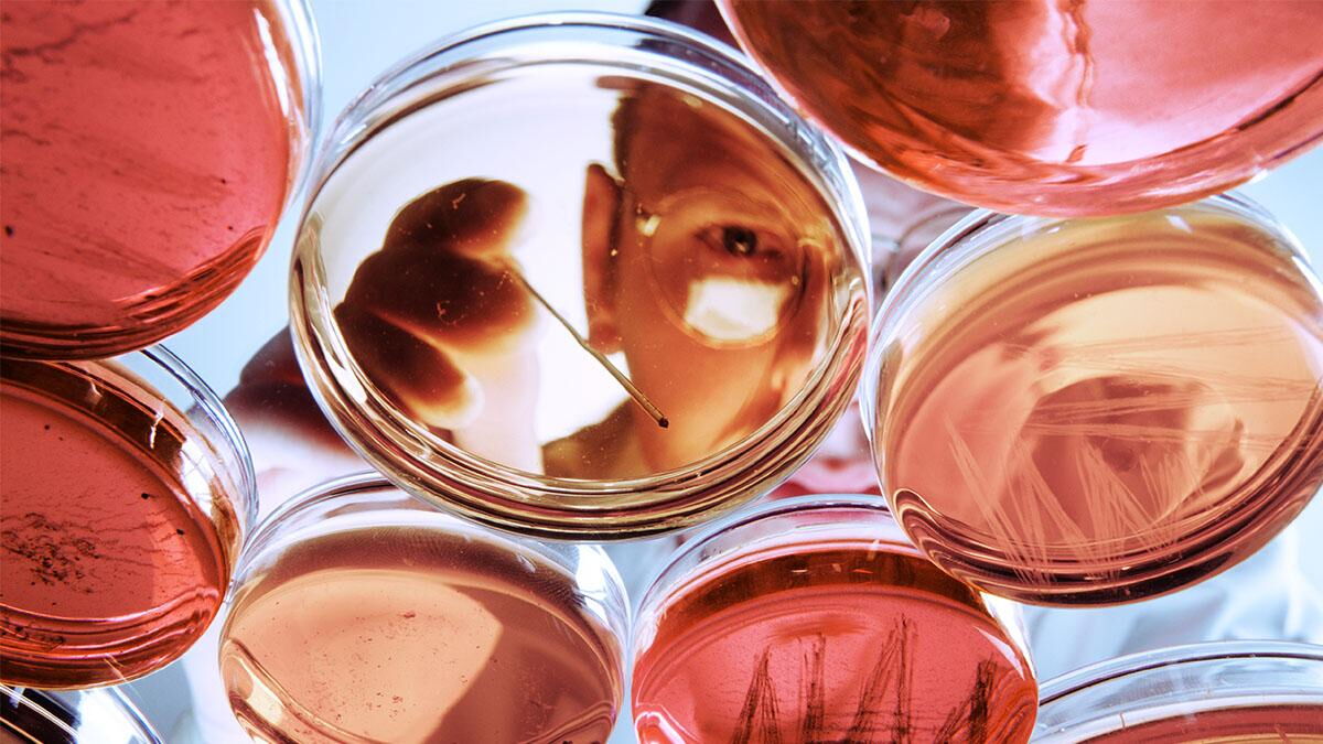 Staphylokokken: Ansteckung, Symptome und Behandlung