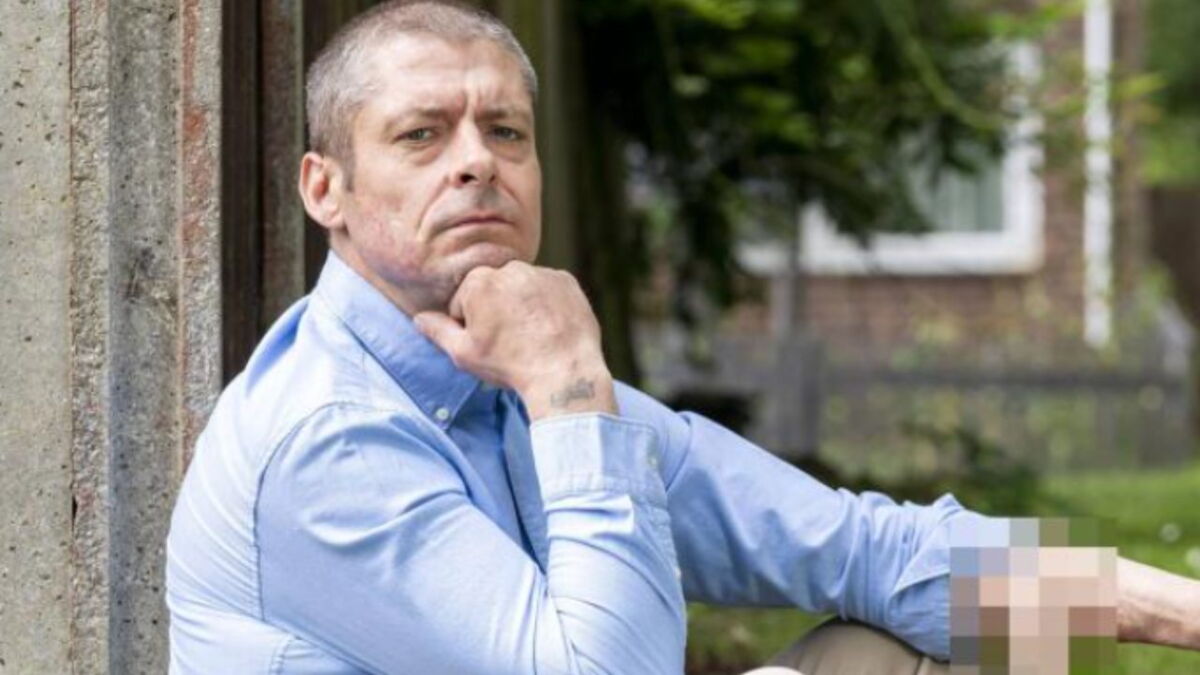 Brite lebt 6 Jahre mit Penis am Arm: "Das könnte ein Wendepunkt in ...