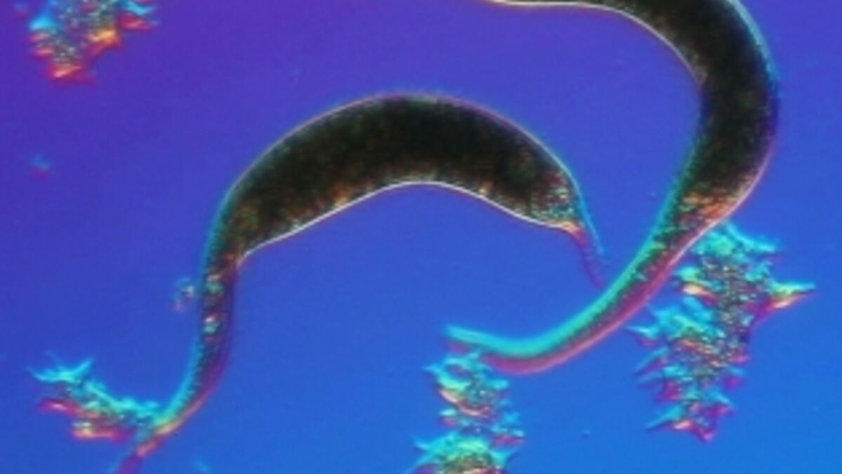 L'étonnant monde microscopique caché dans une goutte d'eau d'étang