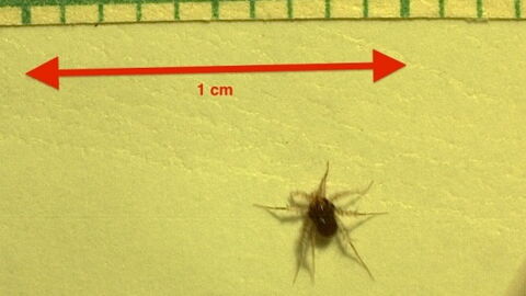 Comment reconnaître une allergie aux acariens ? Découvrez les symptômes ...