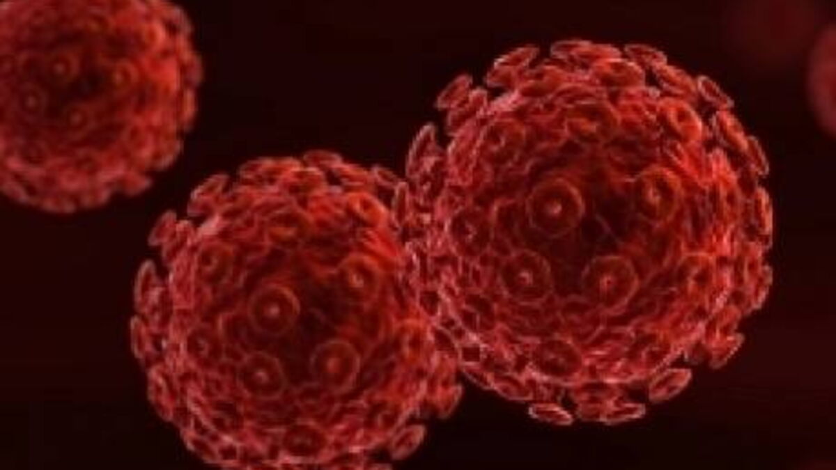 Sida : nouvel espoir de traitement grâce à des chercheurs israéliens