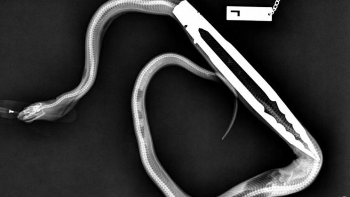 Le fantastique sauvetage d'un python qui avait avalé des pinces à barbecue