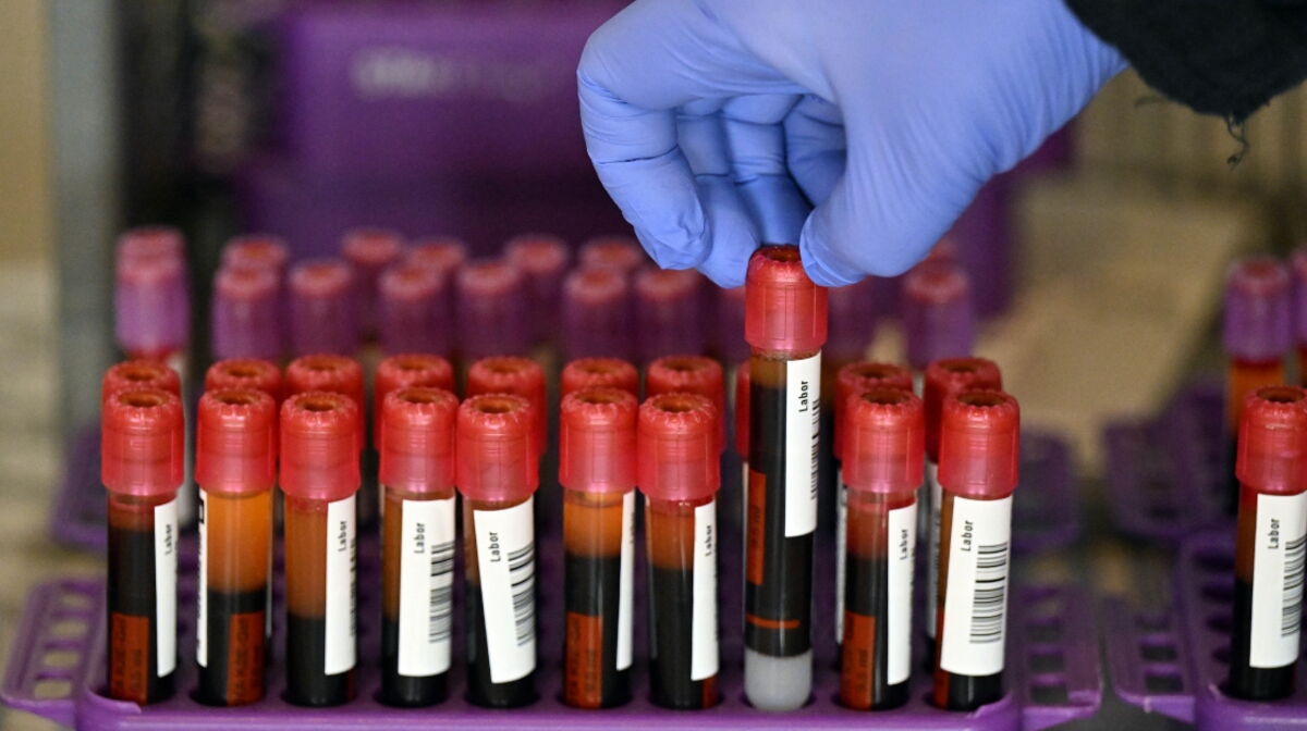 Une étude révèle la présence de plastique dans le sang humain ! Et c ...