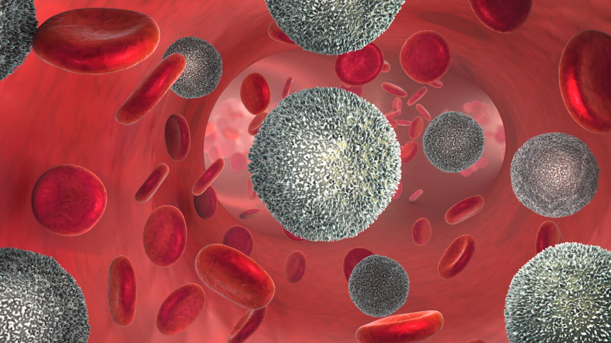 Leucémie : symptômes, traitement, définition, de quoi s’agit-il