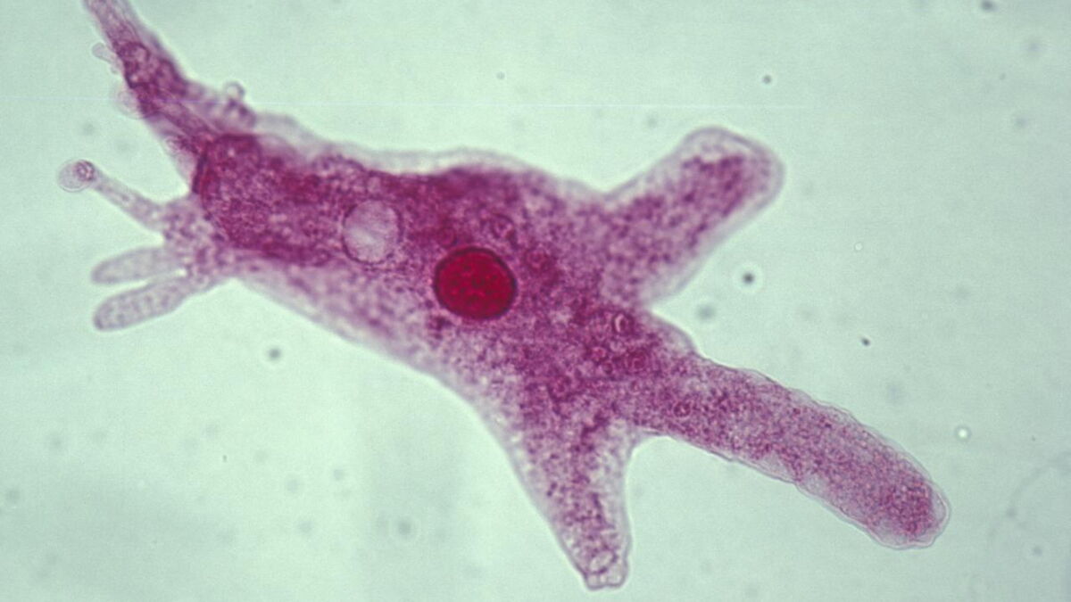 Victime d'une amibe "mangeuse de cerveau", un adolescent perd la vie lors d'une baignade