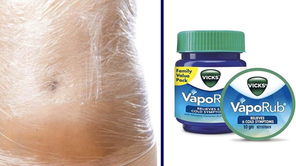 She Simply Uses Vapor Rub On A Daily Basis And It Works Wonders