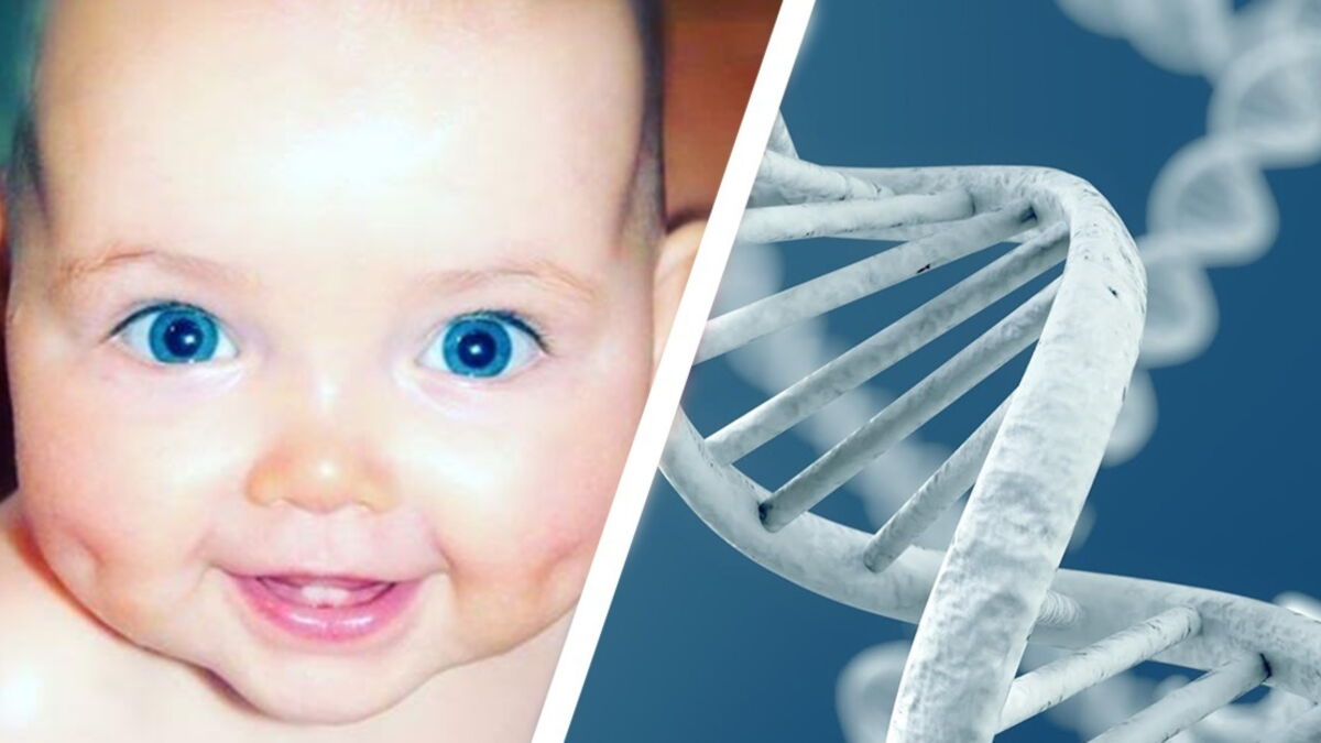 This Precious Baby Has A Genetic Mutation, Can You Tell What It Is?