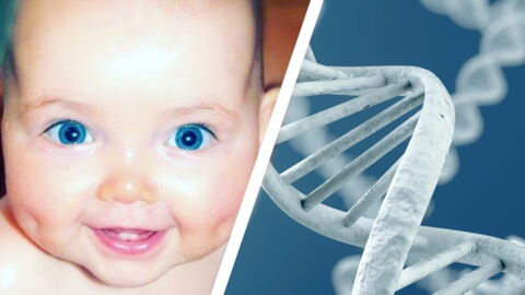 This Precious Baby Has A Genetic Mutation, Can You Tell What It Is?