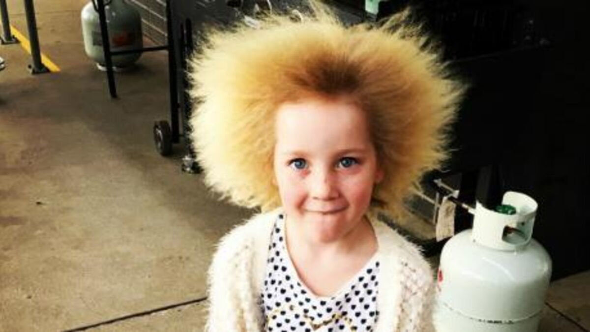 This Little Girl Is One of 100 People in the World Who Suffer From This ...