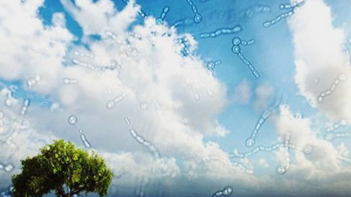 This is the real reason you get little blobs of light in your vision