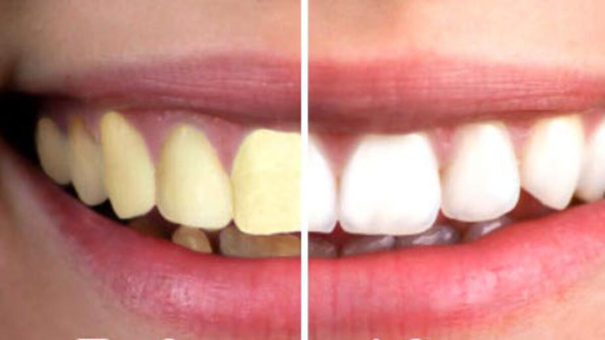 This Simple, Natural Product Will Give You Pearly White Teeth