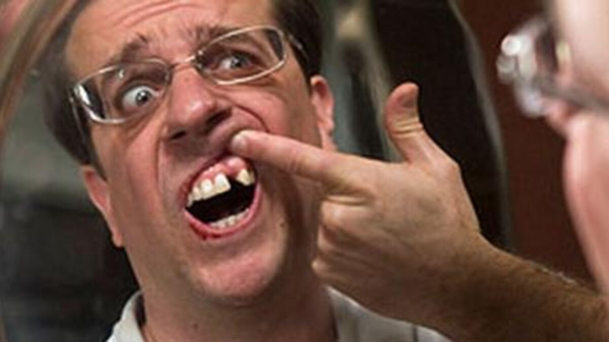 This Is What It Really Means If You Dream Of Your Teeth Falling Out