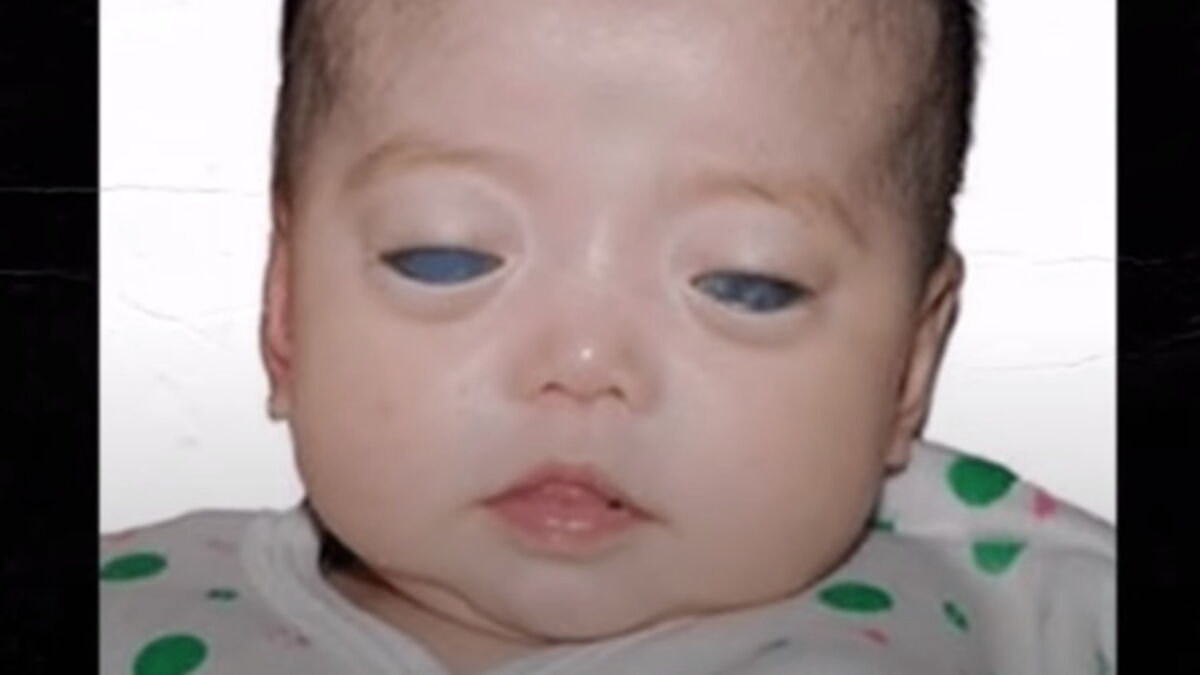 Primrose, The Little Girl Born With Silver Eyes Who Was Abandoned, Is ...