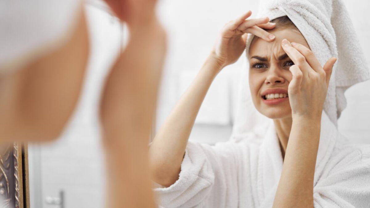 Lockdown might be the reason why you're seeing more spots appear