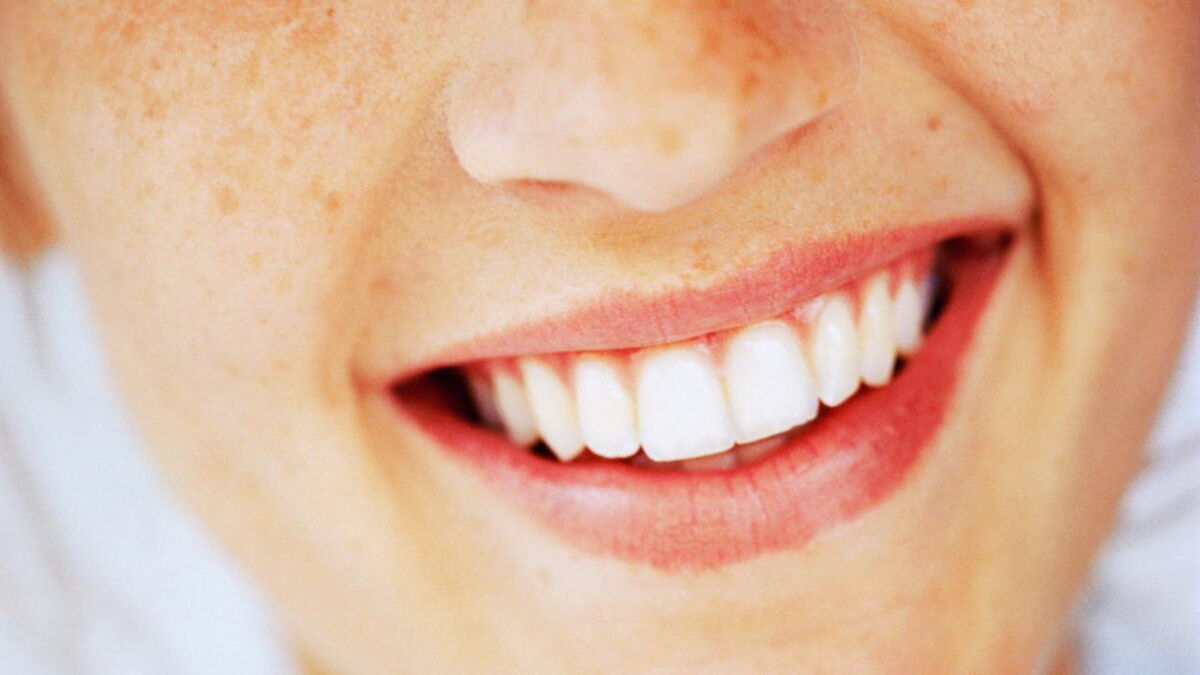 These popular teeth 'hacks' could cause you permanent damage