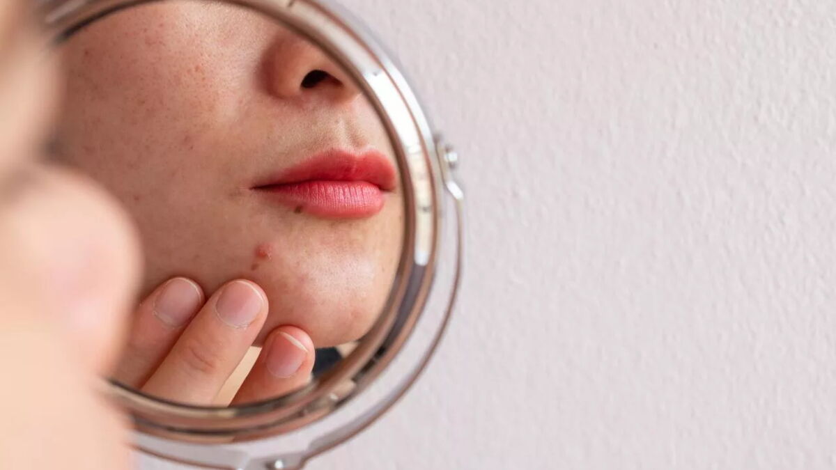 These skincare ingredients might be making your skin break out