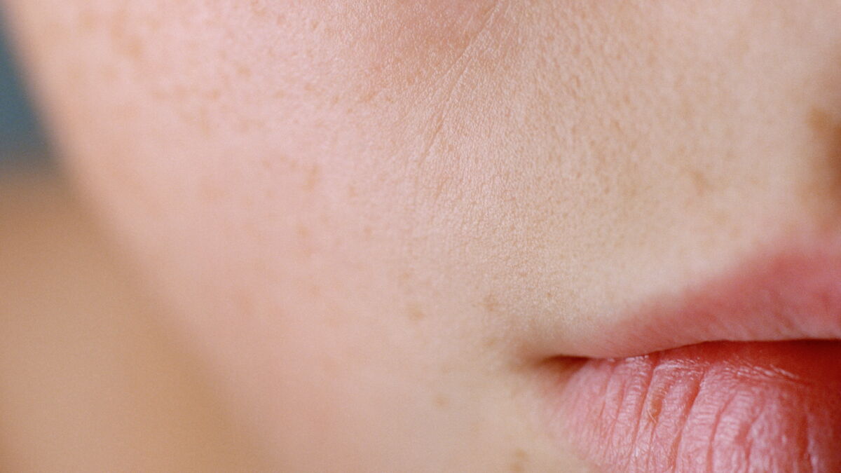 This is what your skin reveals about your health