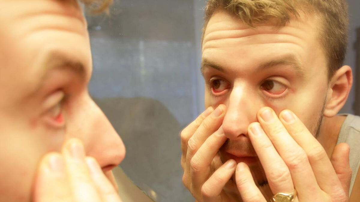 Watery eyes: Here's what it could mean for your health