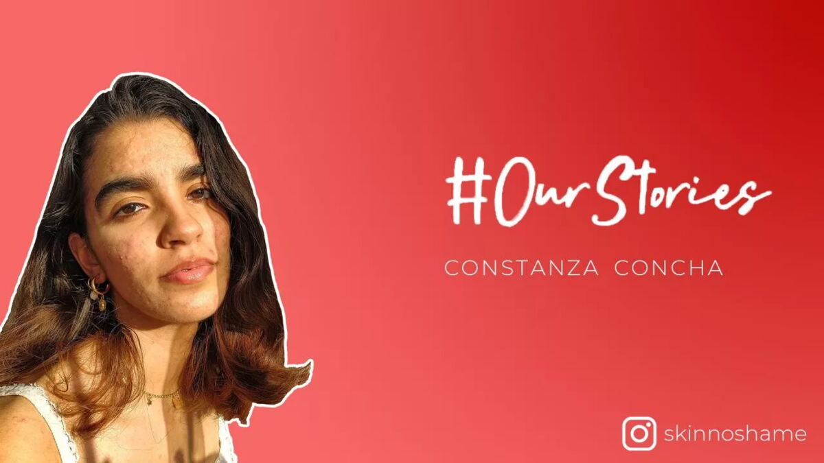 In conversation with skin positivity influencer Constanza Concha