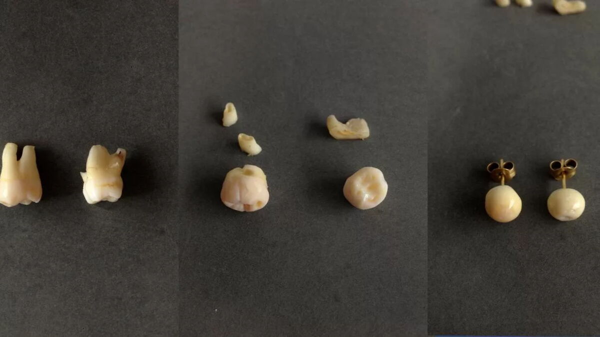 This Woman Makes Jewelry Out Of Human Teeth To Fight Against Elephant ...
