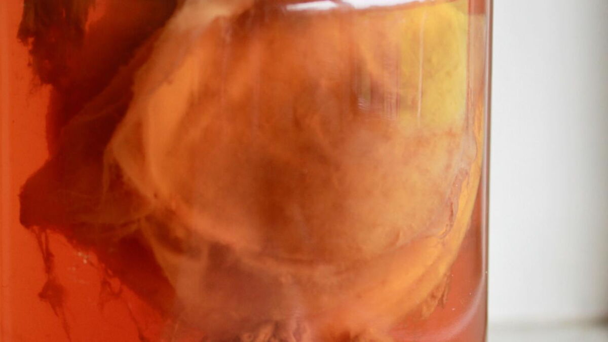 The amazing detoxifying benefits of kombucha