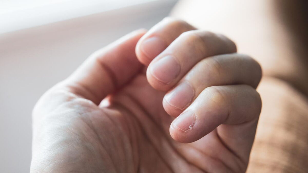 What does the colour of your nail say about your health?