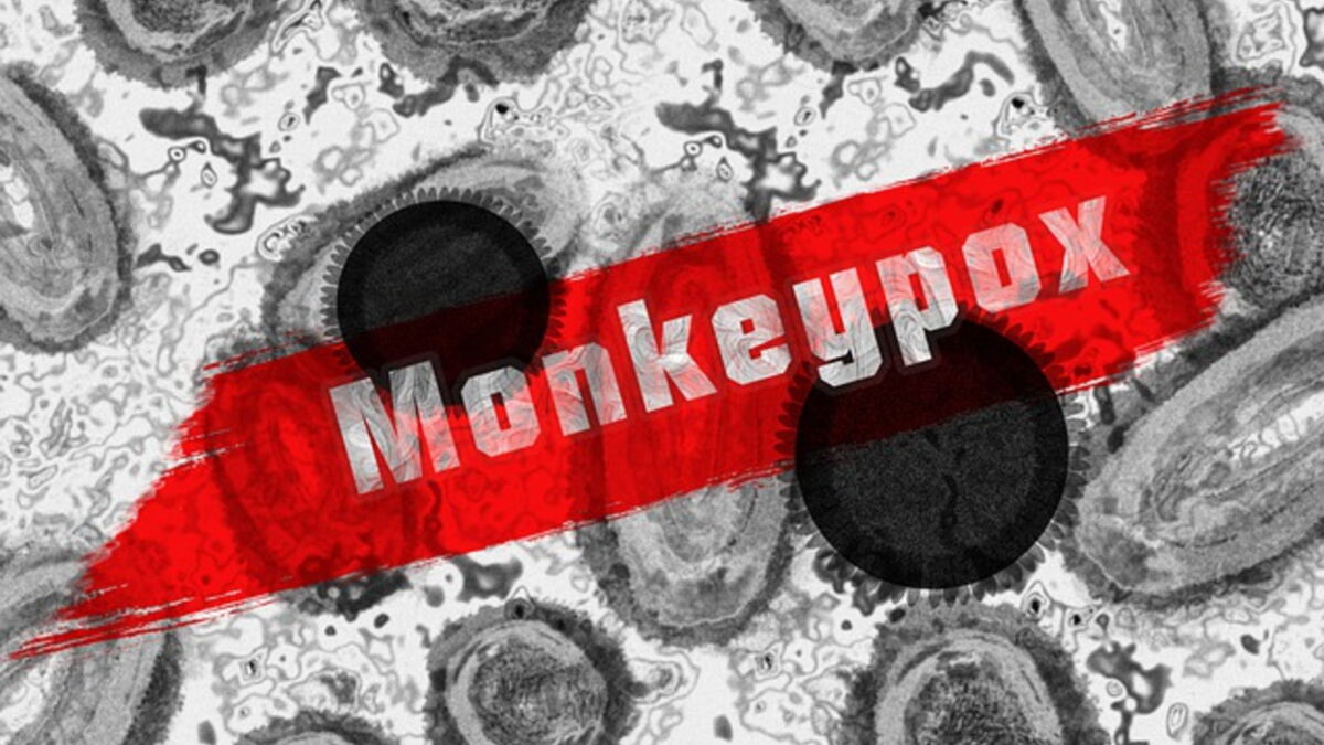 Monkeypox: This unexpected symptom has been revealed by a recent study