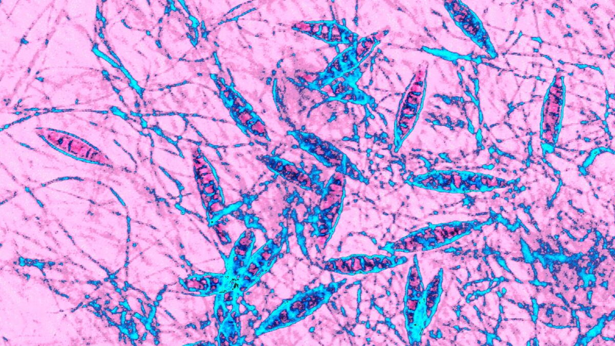 Fatal plant fungus infects man for first time and experts are on high ...