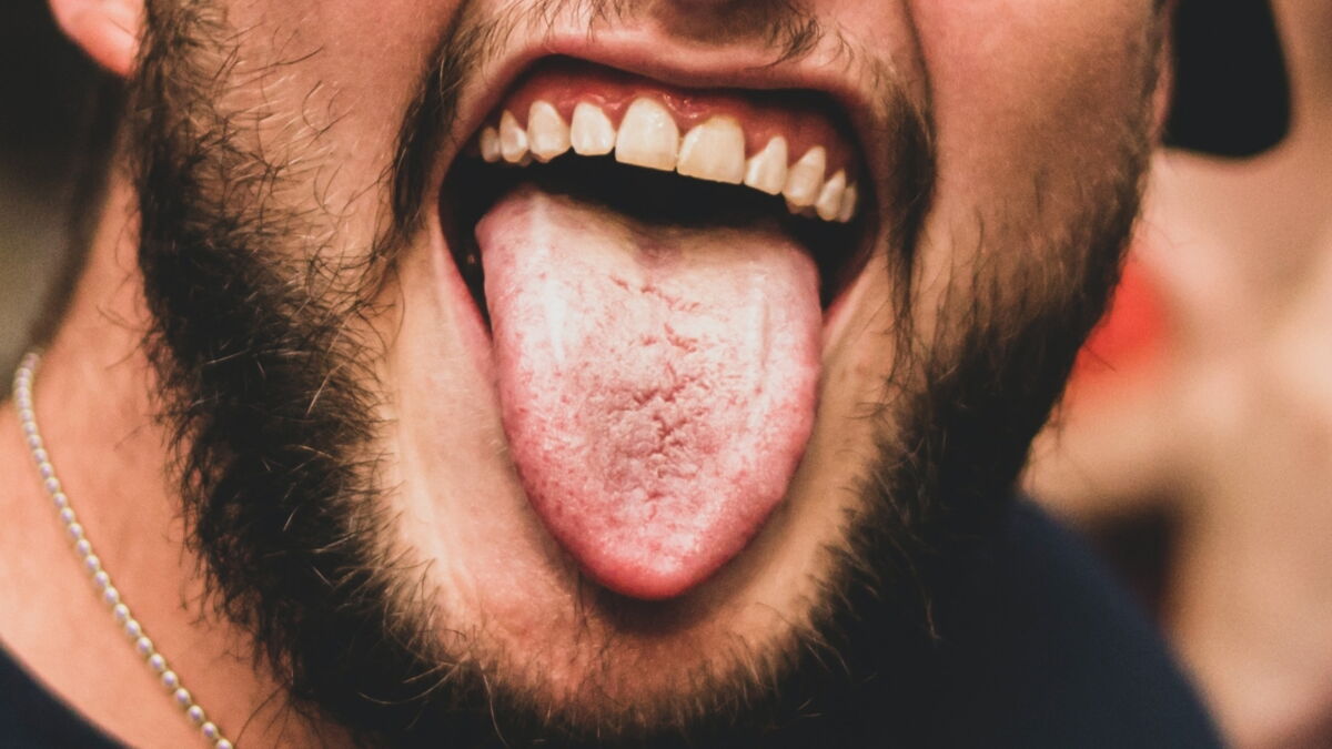 Hairy tongue: This man was diagnosed with this rare condition after his ...