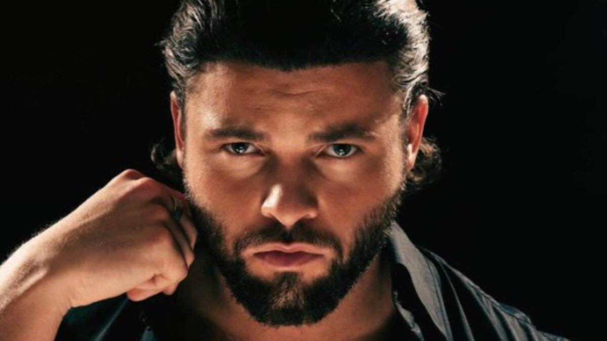 Love Island’s Jake Cornish’s hair transplant gets crazy reactions ...