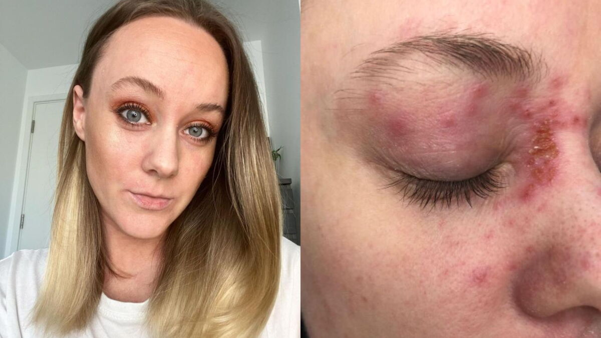 Woman’s face smells like ‘rotten skin’ after using this topical treatment