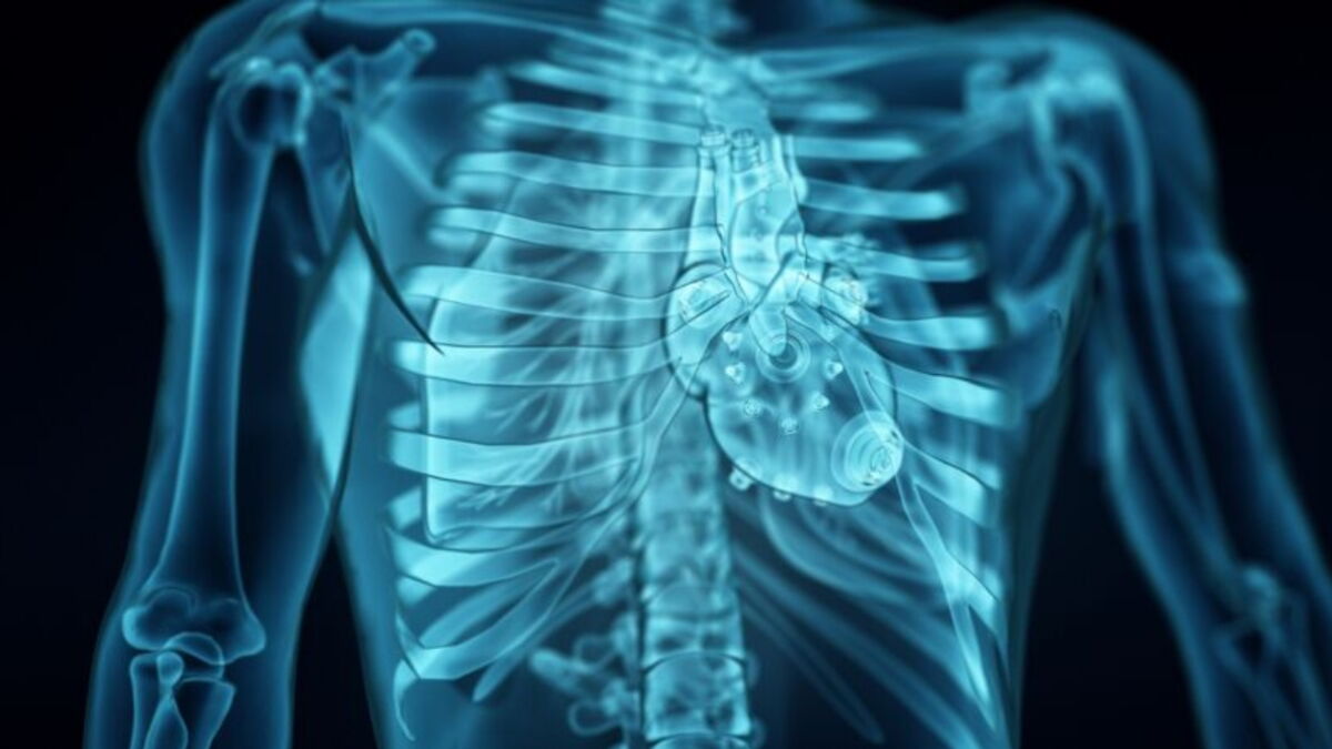 This woman has had 'no pulse' for a year - here's how she survives